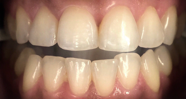 Before / Afters | Smile Transformation Gallery | Dr Whyte Smile