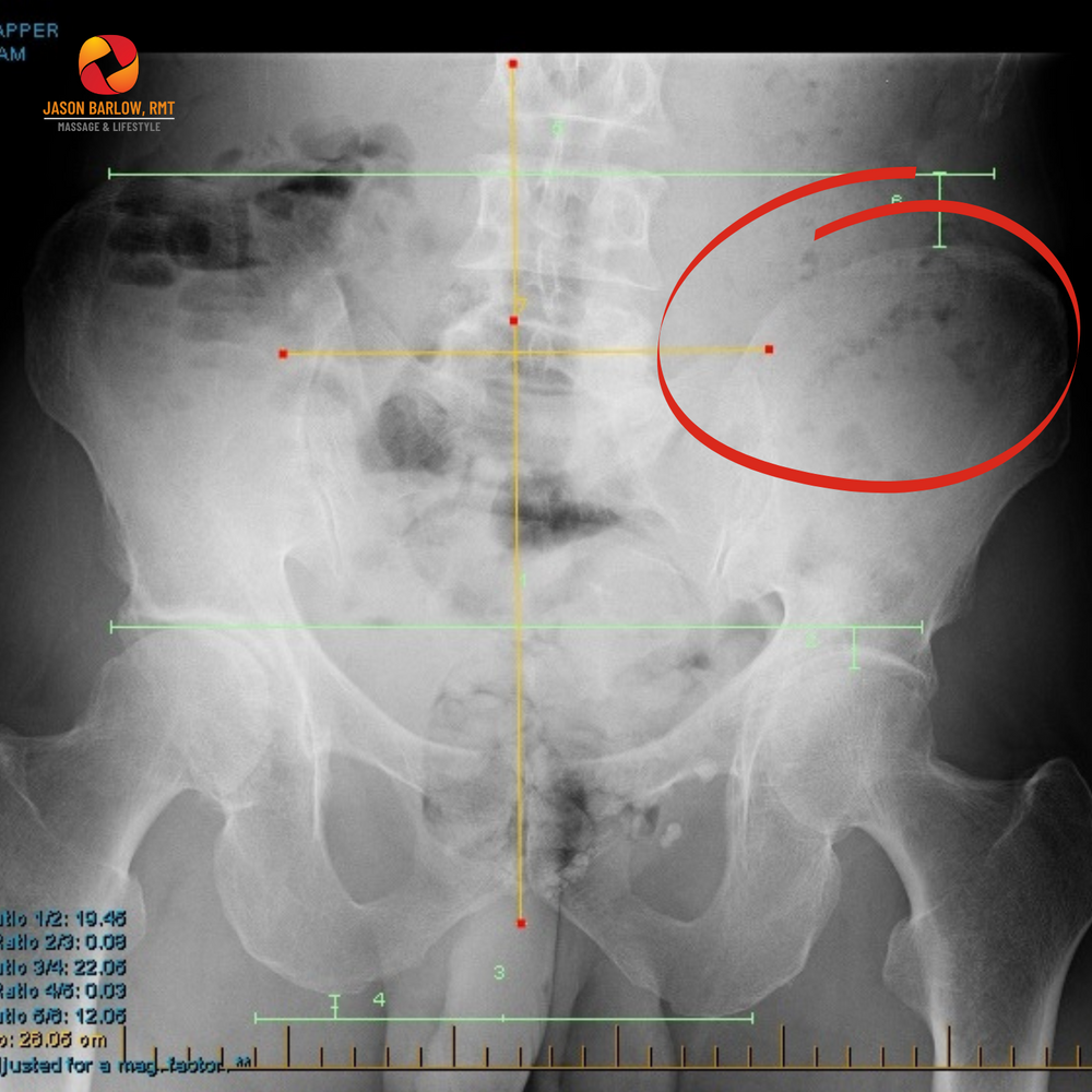 WARNING: here's what every back pain sufferer needs to know about the ...