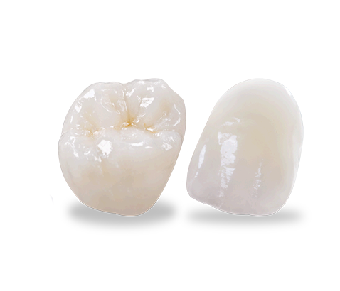 Kofa Dental Laboratory | Monolithic Glass Ceramics