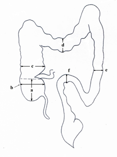 Radiological anatomy of the colon | drlevinmichael