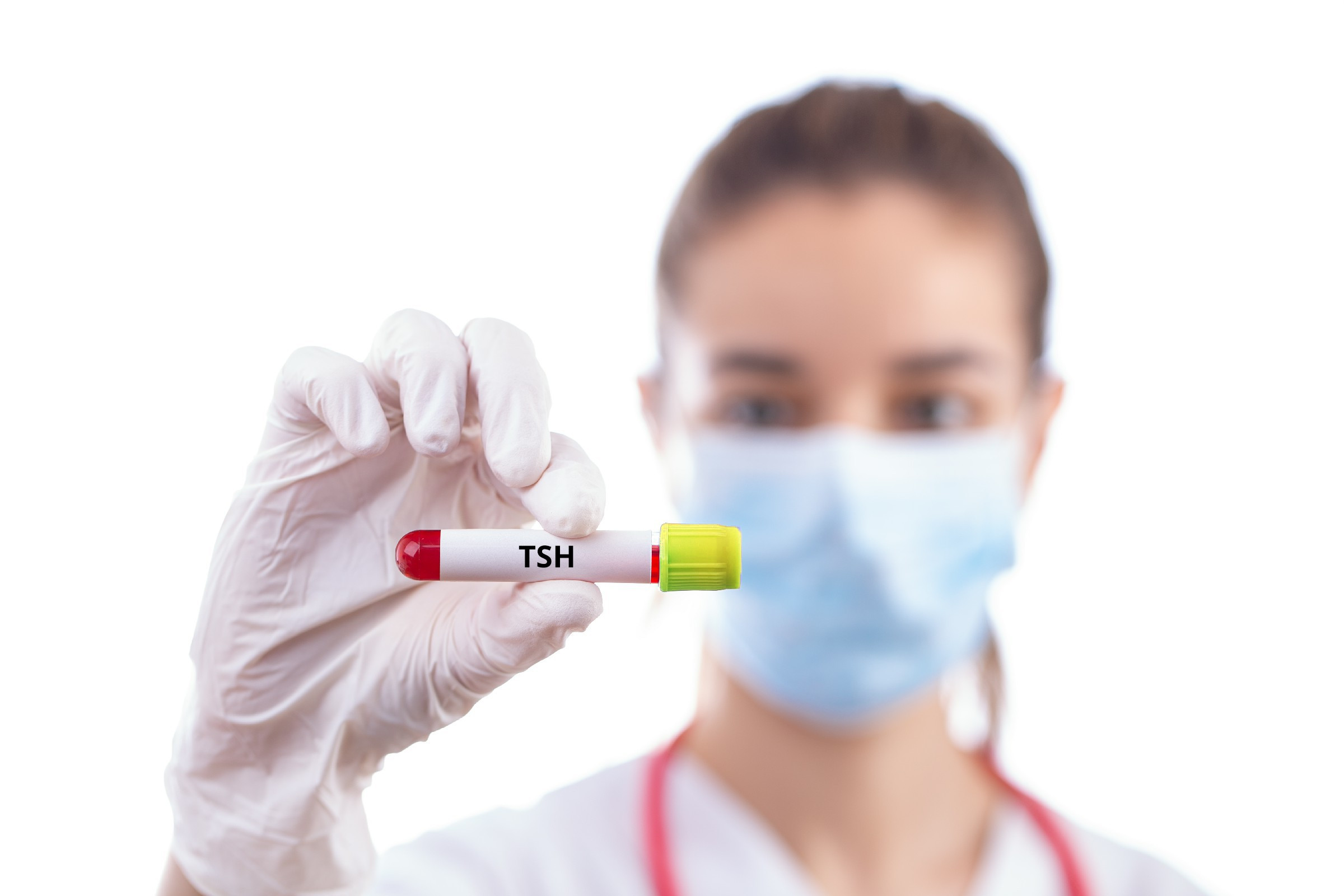 Medical-Service |TSH בדיקות דם באופן פרטי | בדיקת