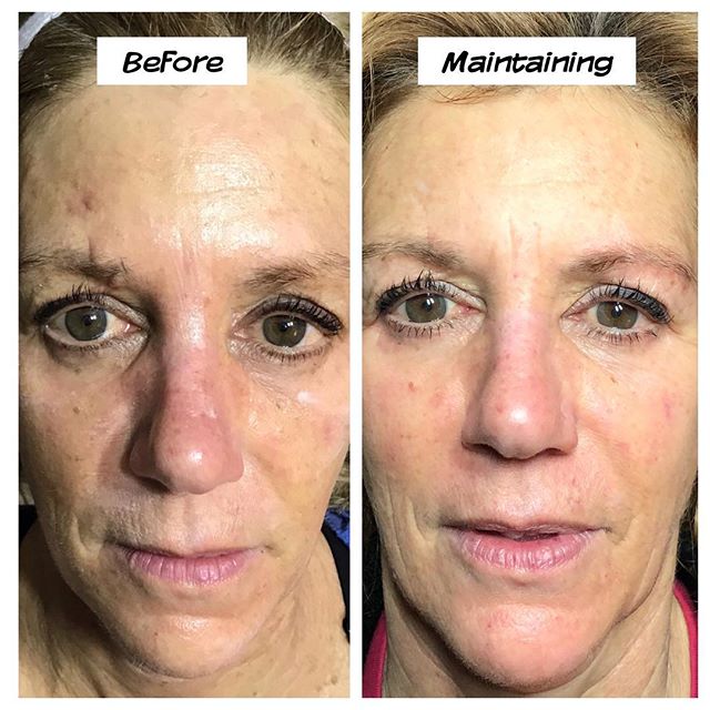 Tranquility Skin Services | Before and Afters | Farmington