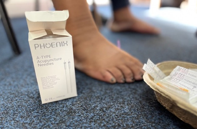 Community Acupuncture Clinic in GP practice - reflections from the ...