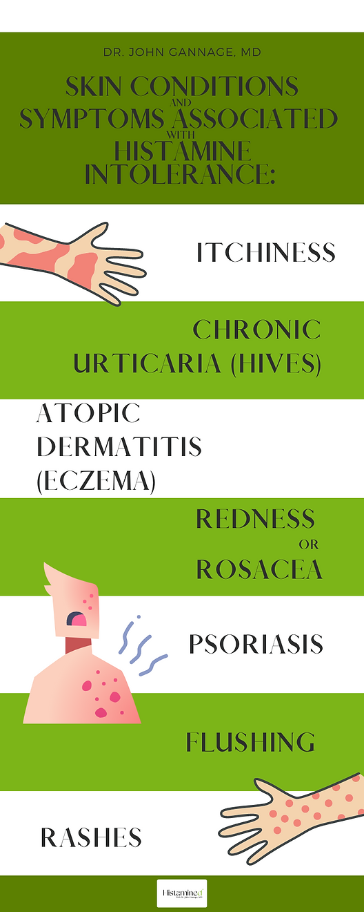 does histamine cause rash