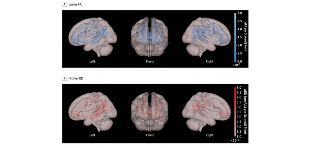 HOW MUCH SCREEN TIME IS OKAY FOR MY CHILD?