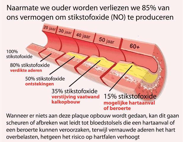 Het belang van gezonde aderen