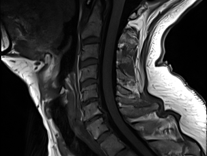 MRI Clinical Applications | InkSpace Imaging