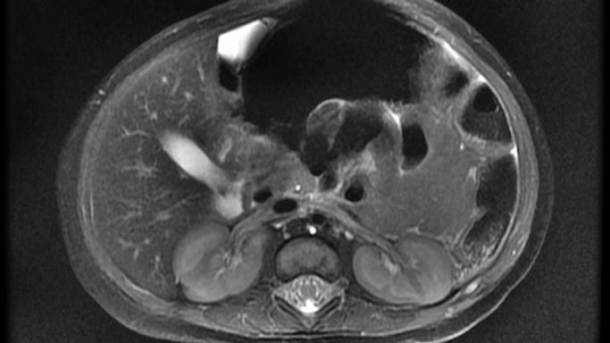 MRI Clinical Applications | InkSpace Imaging