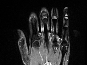 MRI Clinical Applications | InkSpace Imaging