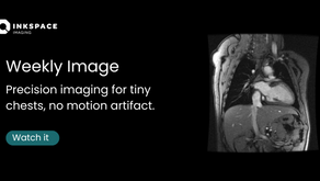 Magnetic Resonance Imaging Coils | Inkspace Imaging