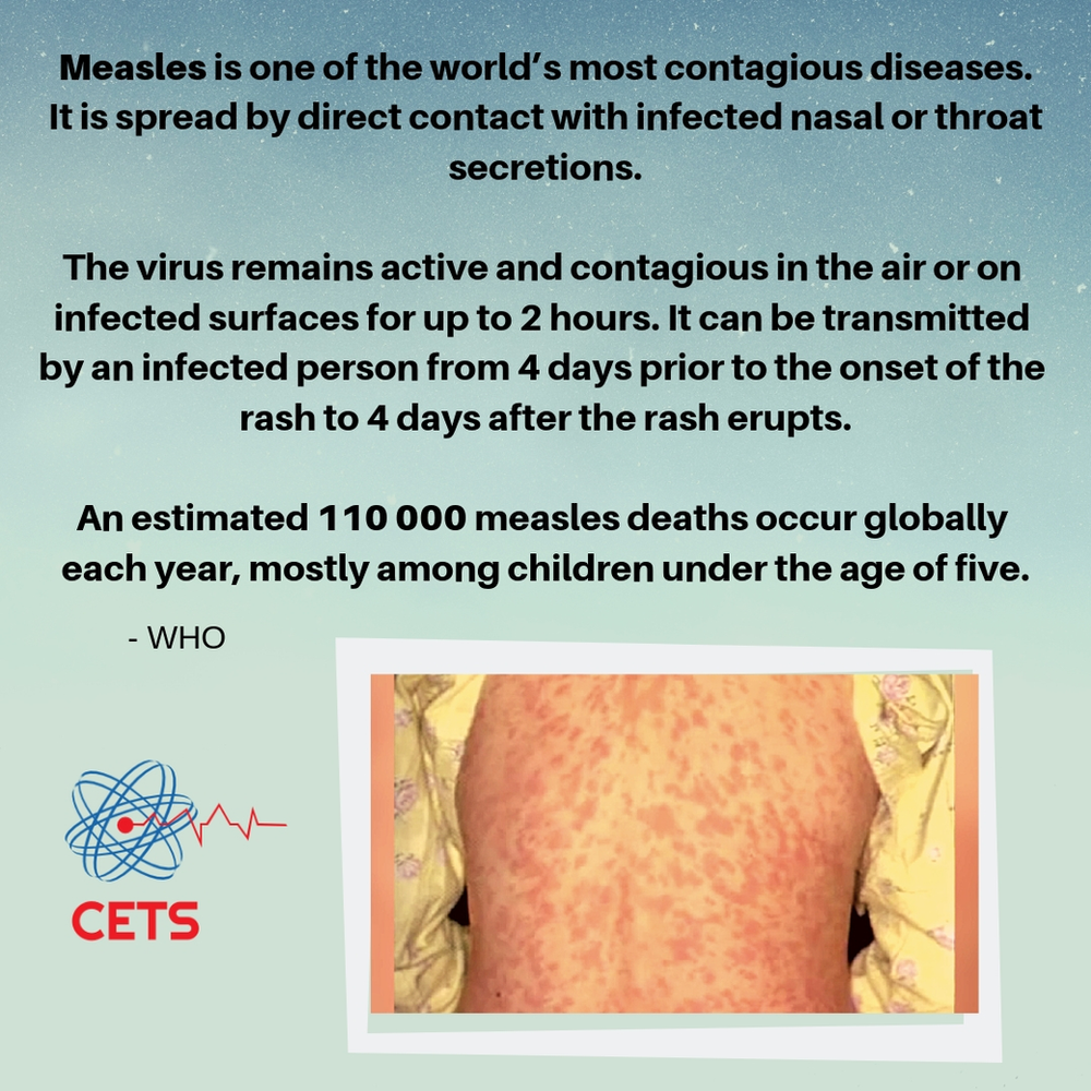 Don't be Measle-y Confused