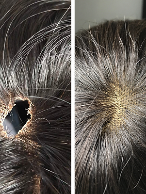 Lace Wigs | The Wig Mechanic: Lace Repair Specialist