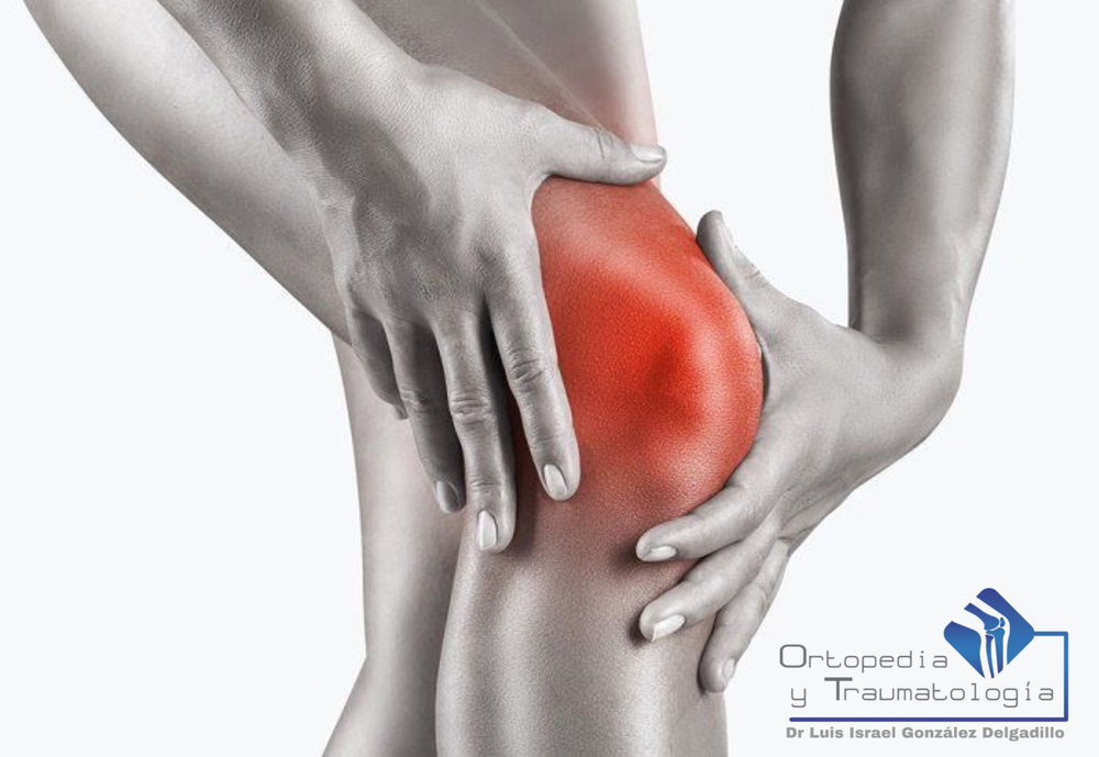 Inflamación de la rodilla. ¿Porque se me inflama?