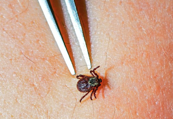 Tick Prevention
