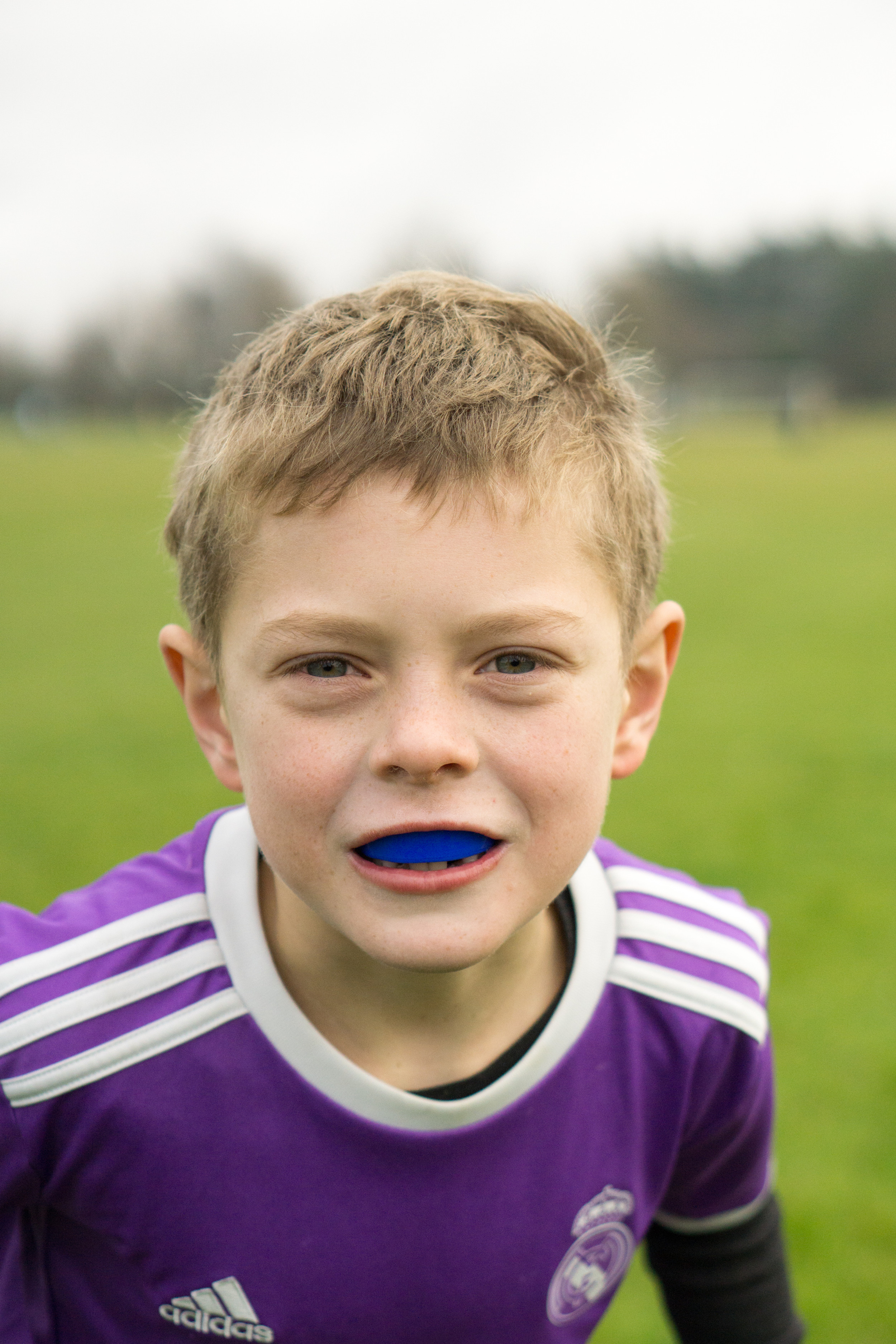 Protect Their Smile: The Importance of a Good Fit for Gum Shields