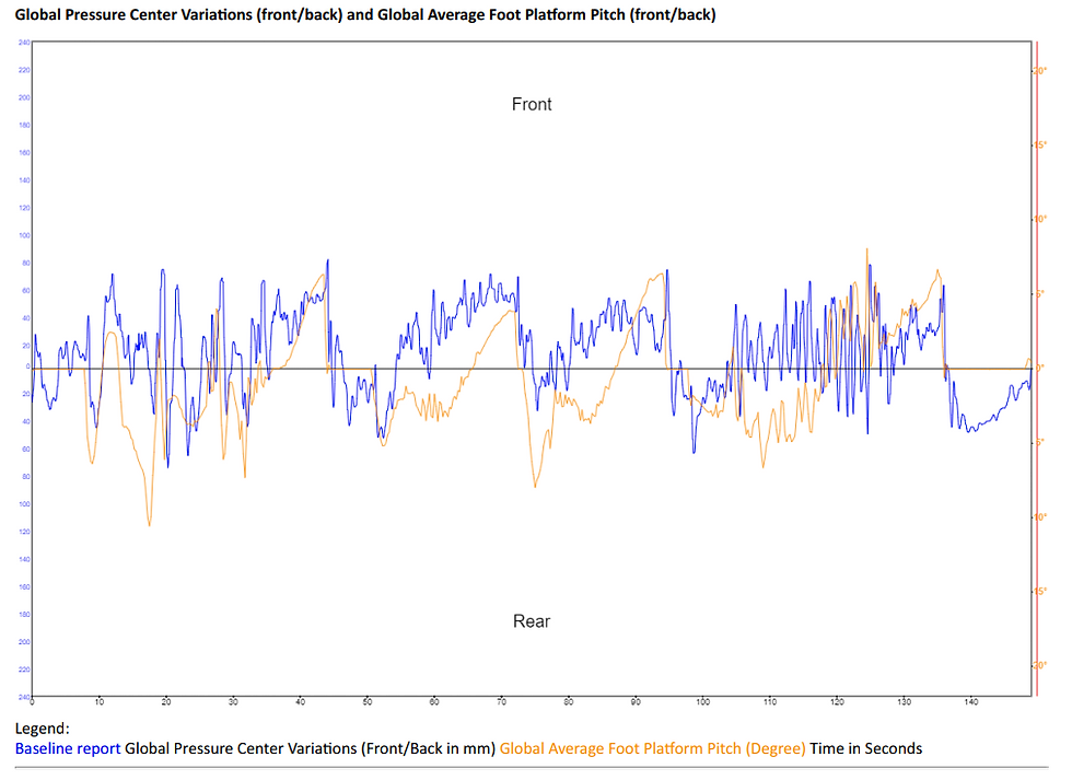 Perturbation-Based Balance Training Perturbation-Based Balance Training