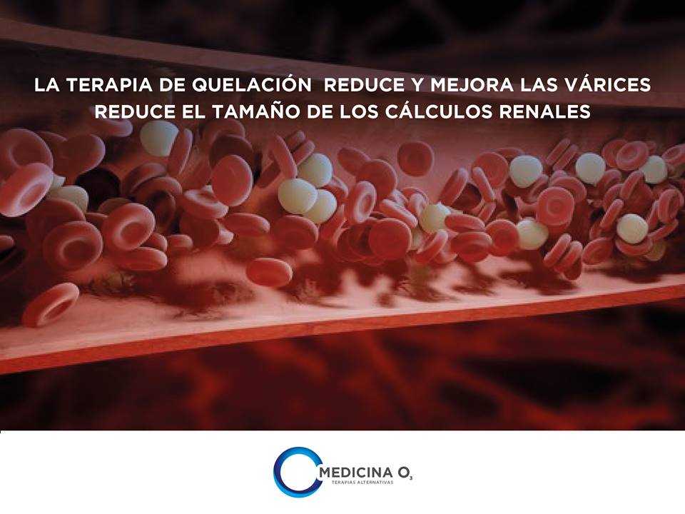 Terapia de Quelación