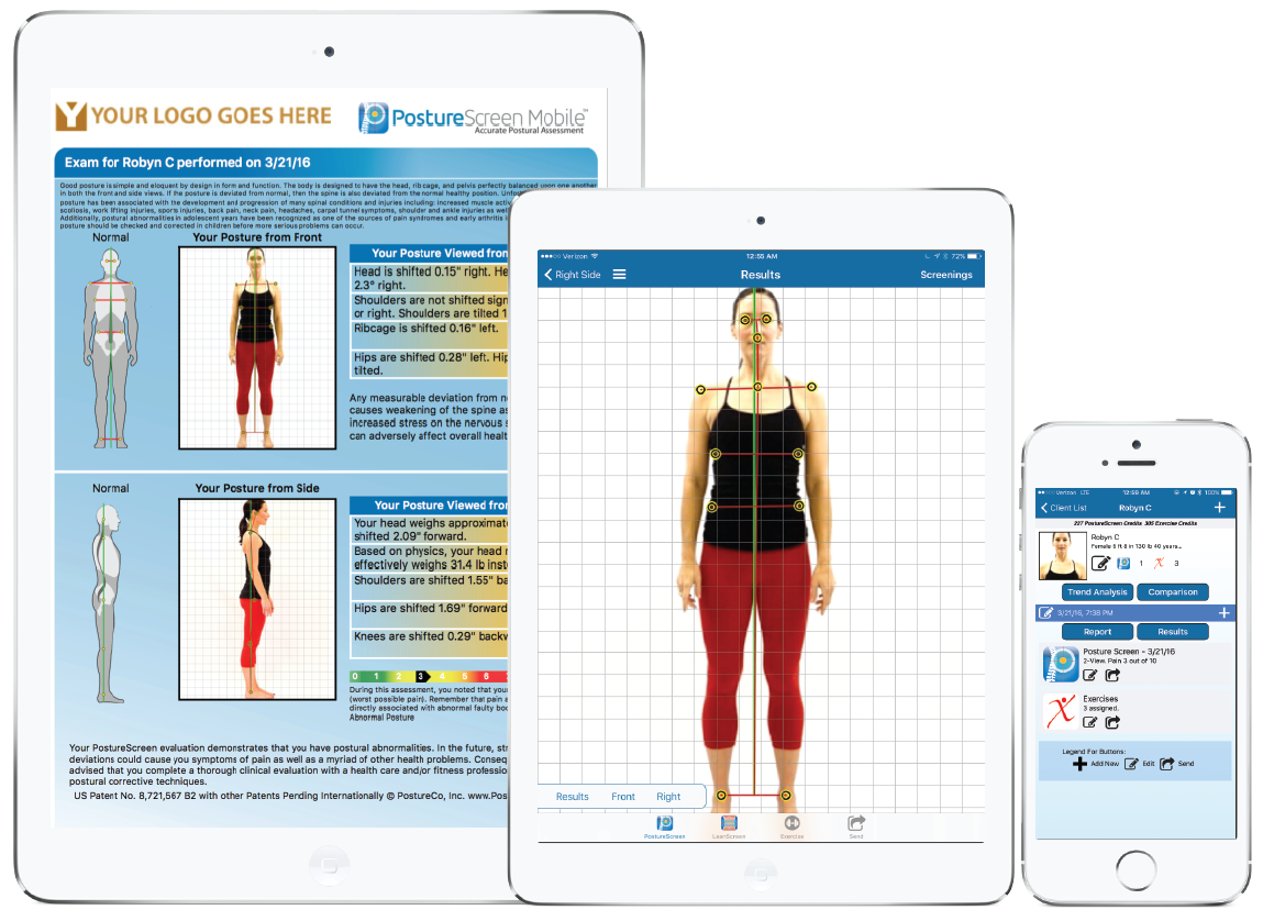 Digital Posture Analysis
