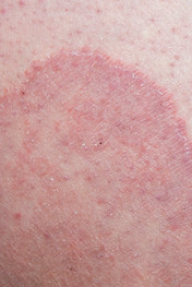 VERSIACTIVE | Celltech