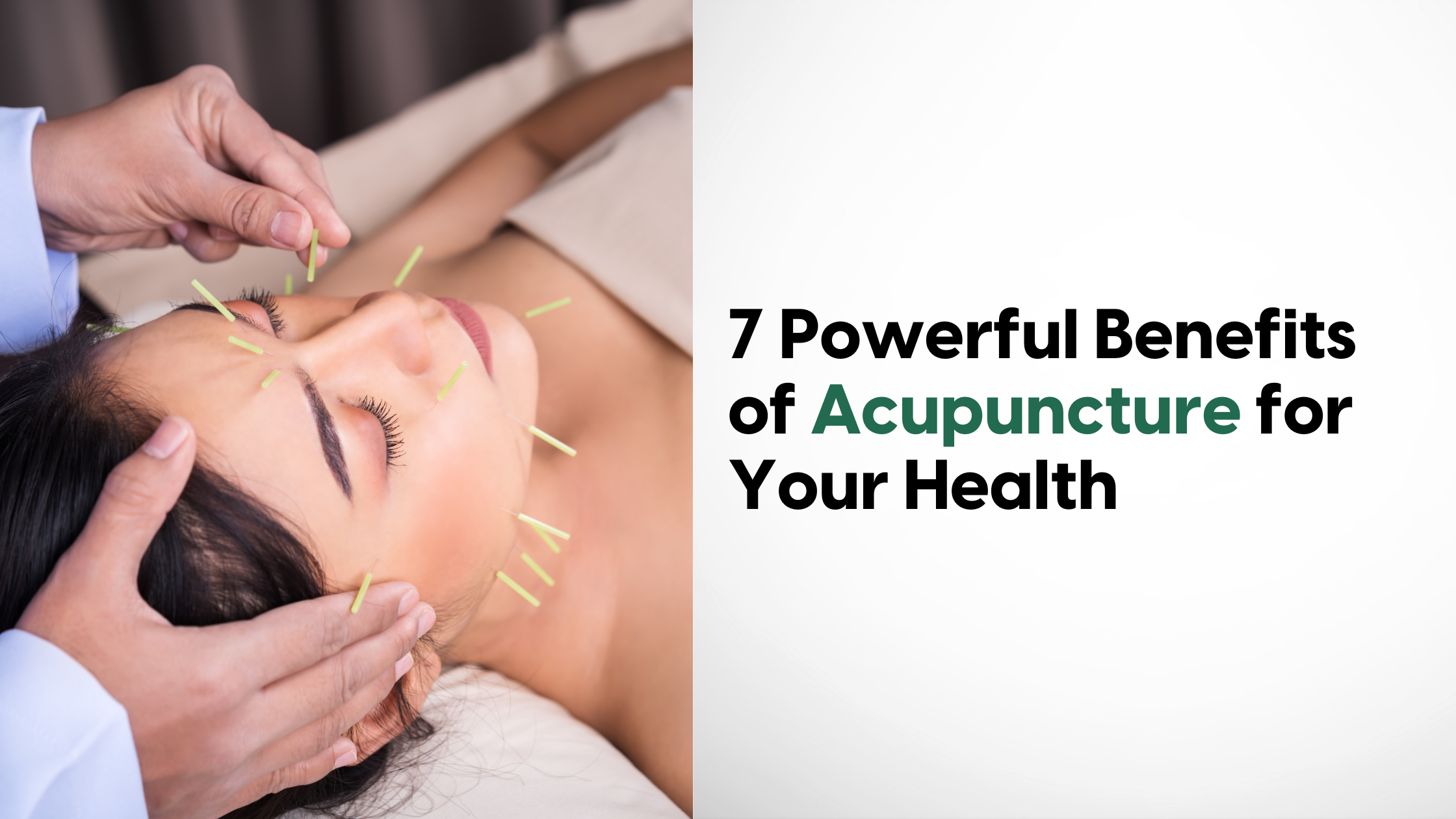7 Powerful Benefits of Acupuncture for Your Health