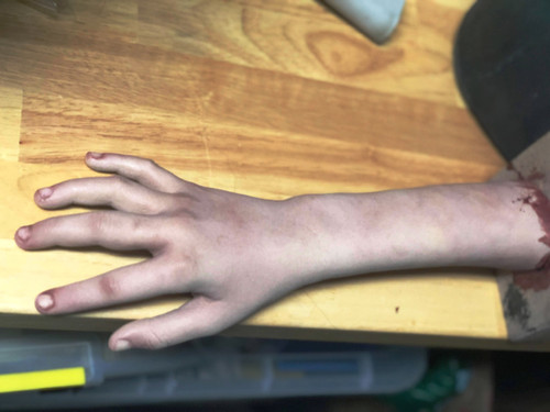 Severed Arm (Child Size) | Madness FX