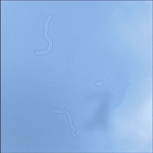 Floaters | TrinidadEyeHospital