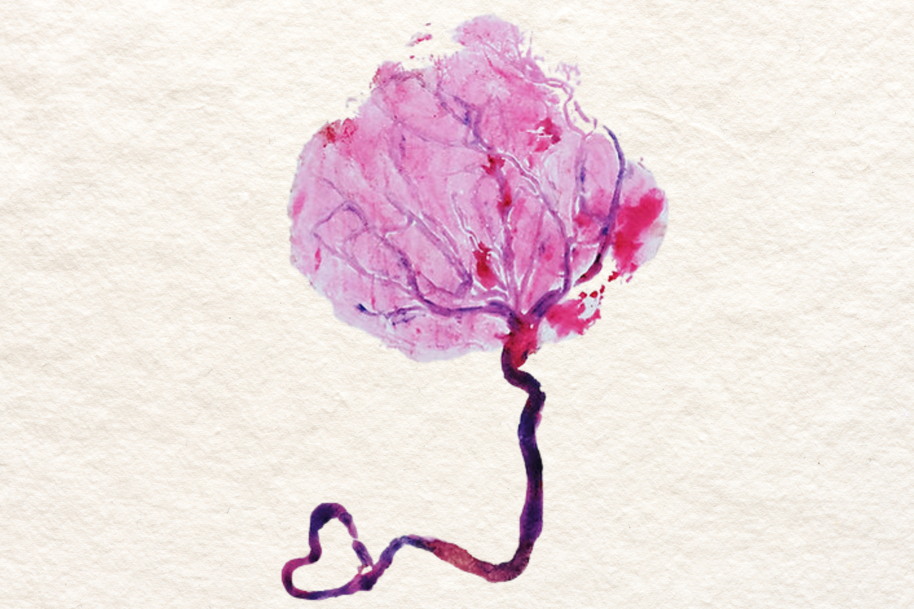 The Art of the Placenta Print: A Unique Keepsake of Birth