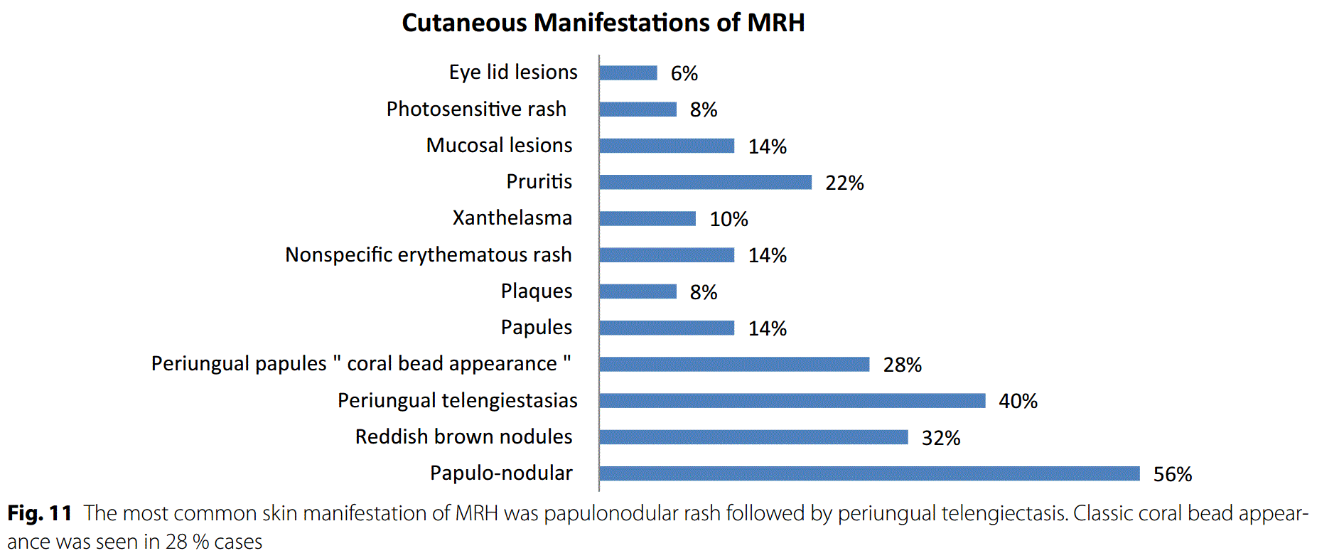Multicentric reticulohistiocytosis（MRH）
