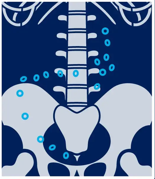 Diagnostic Process — Colonic Transit Study | SITZMARKS®