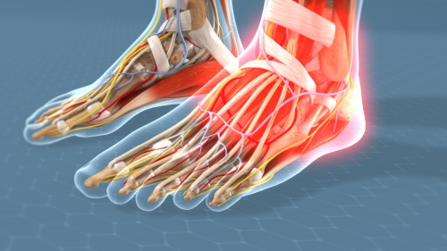 Ankle Arthritis Symptoms & Treatments