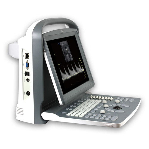 Chison ECO2 VET Ultrasound Scanner | Made for Vets with local service ...