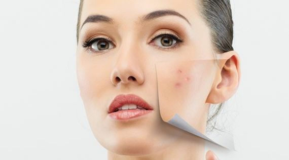 5 Tips para ocultar las Imperfecciones en la Piel