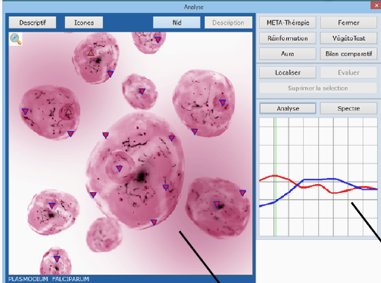 Physioscan | Physioquanta BILAN ENERGETIQUE