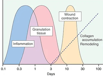 How Inflammation Disrupts Wound Healing in Chronic Wounds