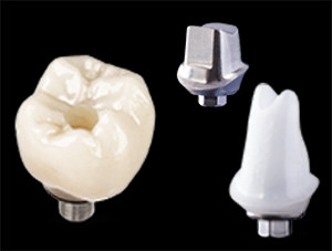 Elite Dental Lab Baltimore | Dental laboratory Baltimore