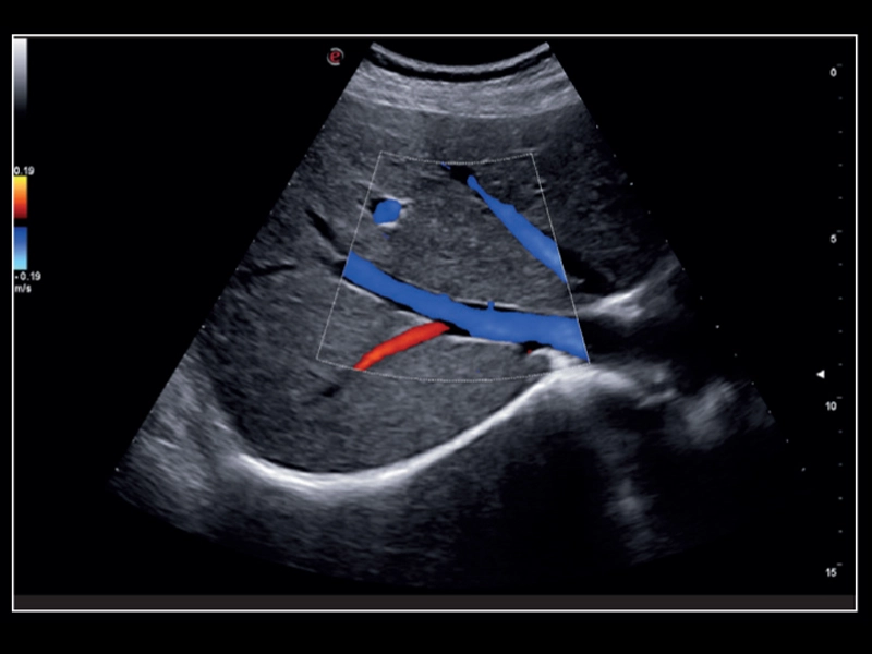 MyLab X8 Exp | Ineqmedica