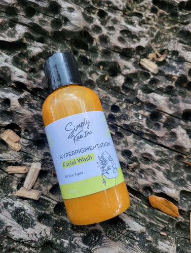 HYPERPIGMENTATION FACIAL WASH 8OZ | Simply Kae Inc