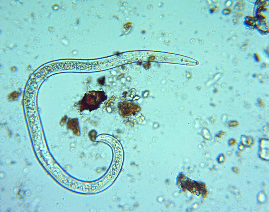 This nematode is awesome to look at. Even though it’s really not so ...