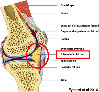 Fat pad impingement