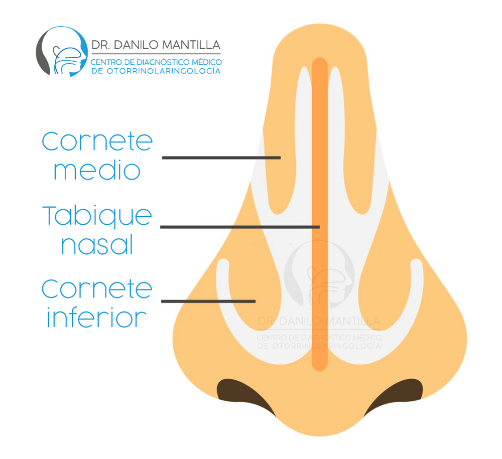 Cirugía de cornetes | Turbinoplastia | Hipertrofia de cornetes | Dr ...