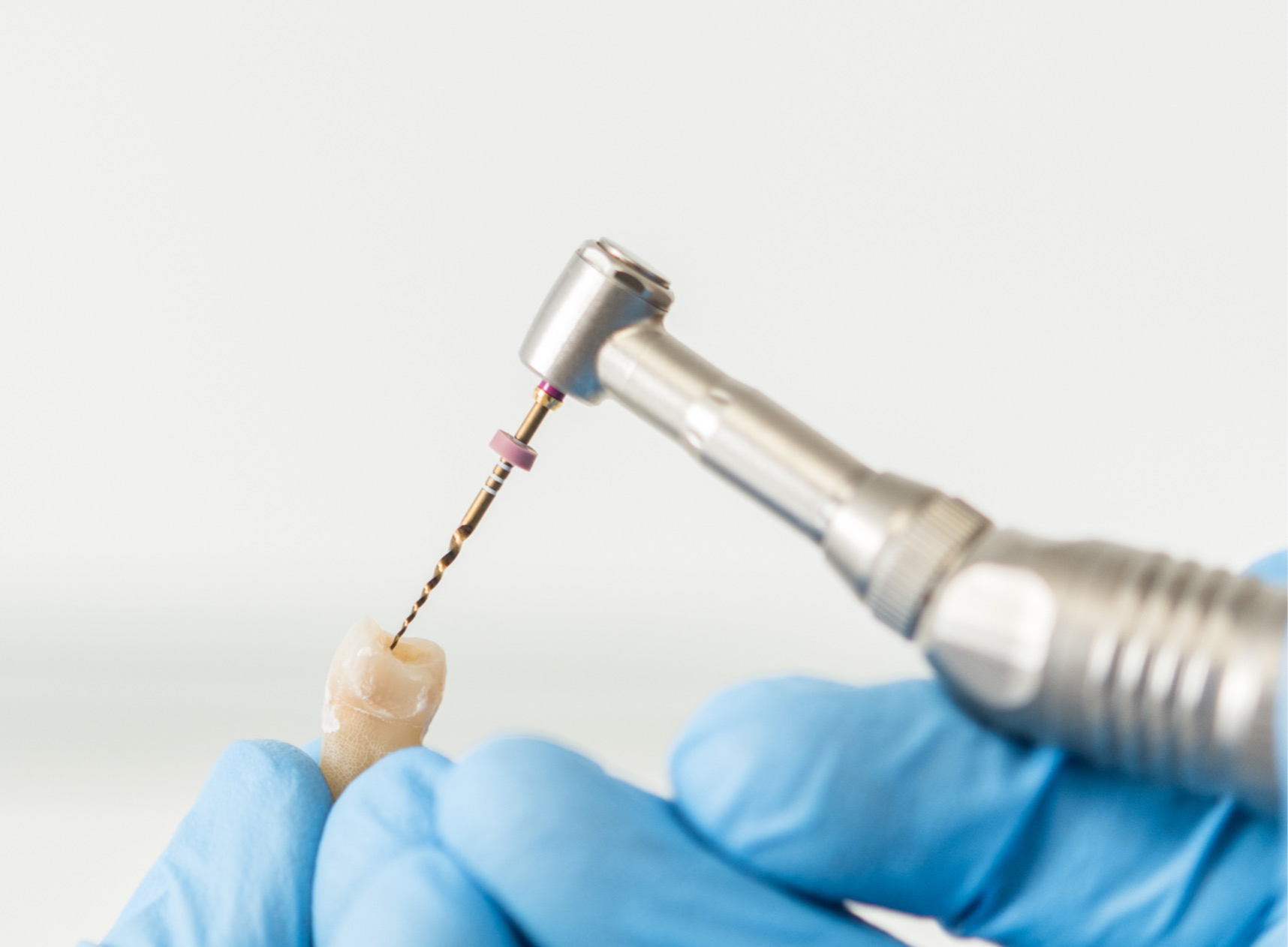 Endodoncija, liječenje zuba - Ćaleta Cupek, Varaždin