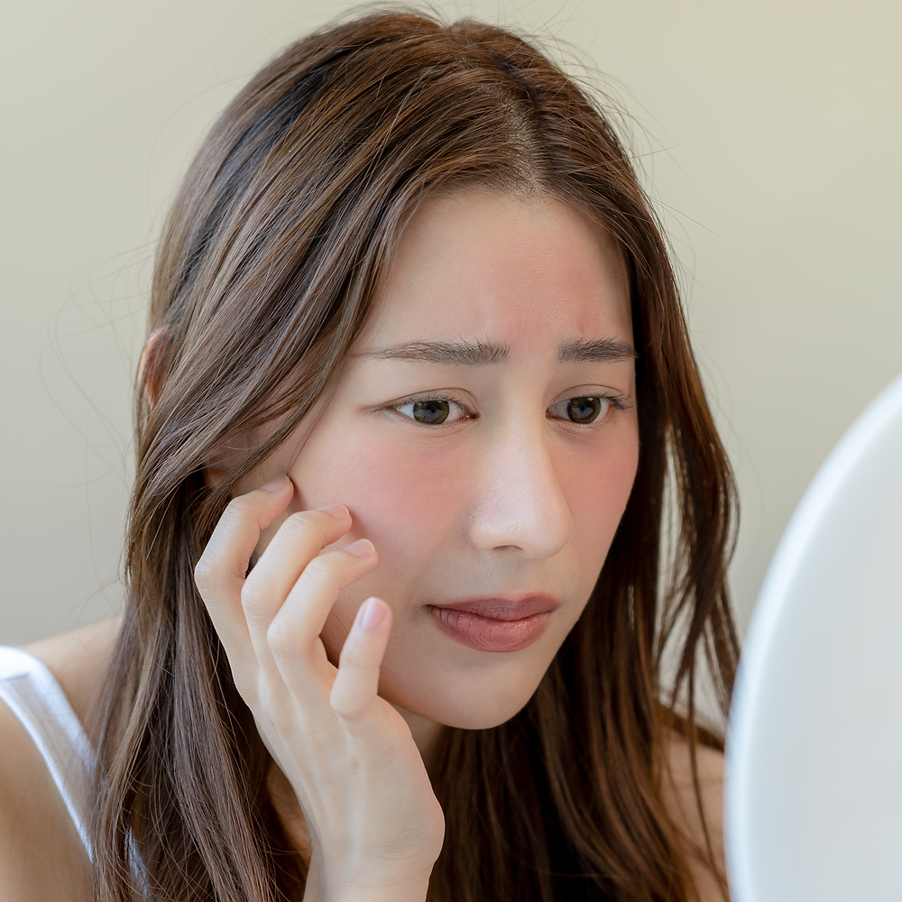 Clogged pores, how to minimize.