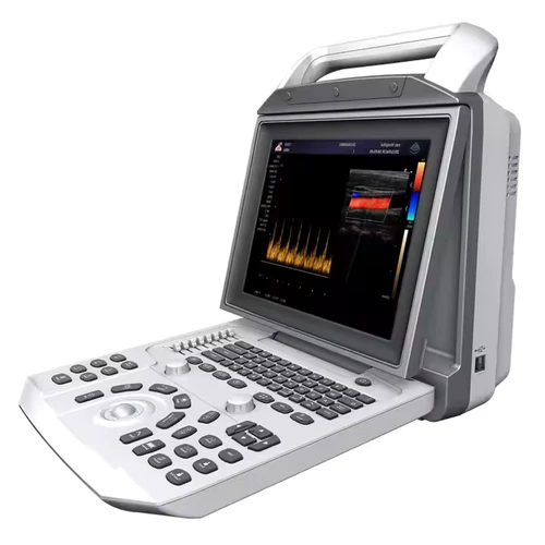 SONOGRAFO DOPLER A COLOR DIGITAL ZONCARE M5 | EMH MEDICAL