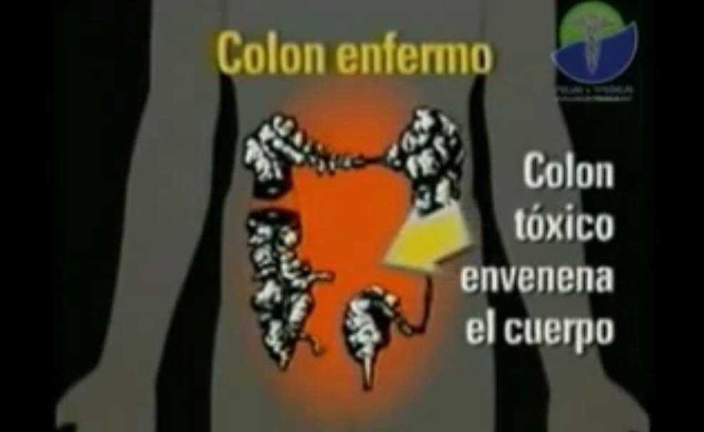 CONSTIPACION O ESTREÑIMIENTO INTESTINAL