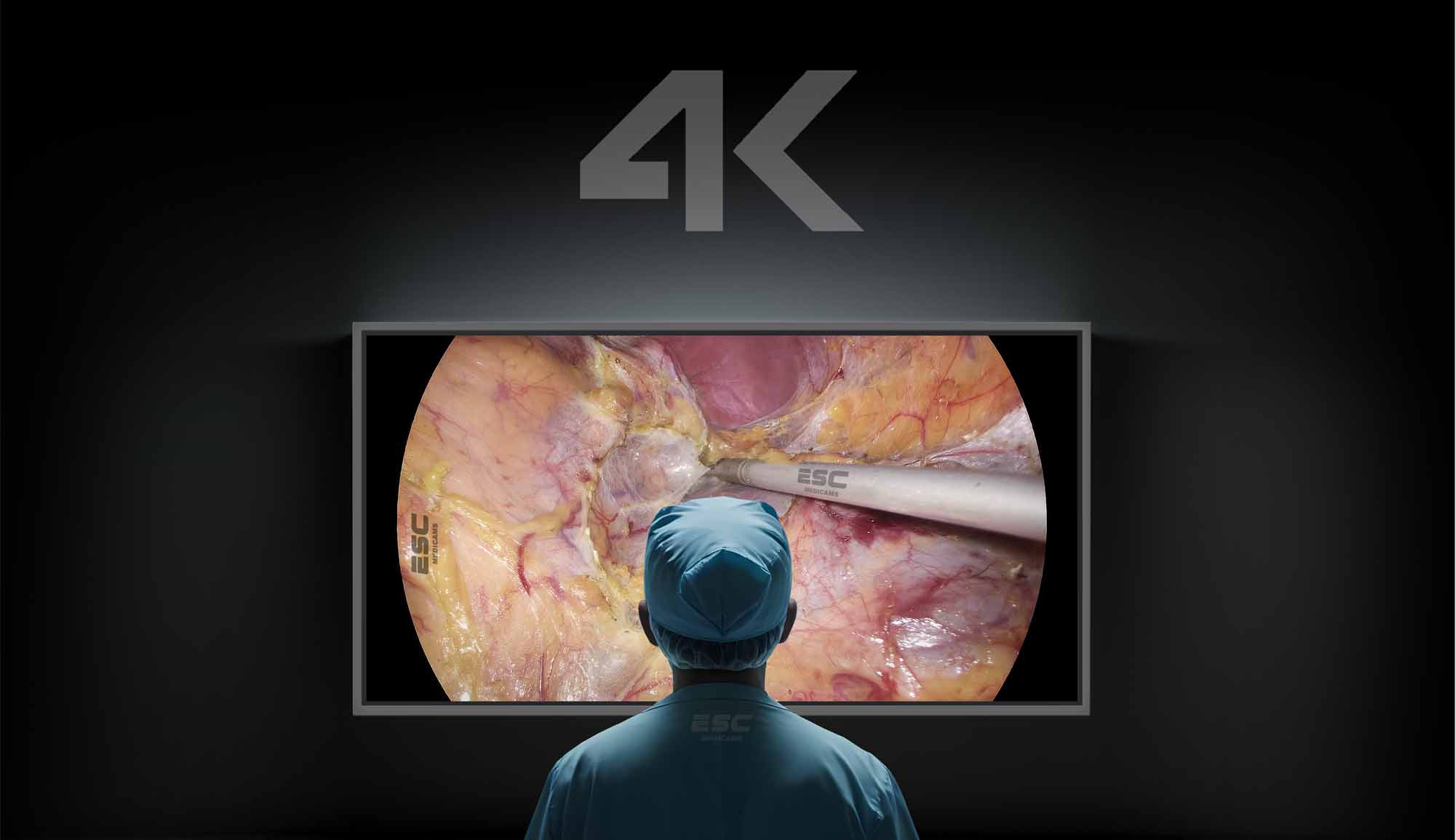 4k Laparoscopic Camera Imaging System UHD-LP-6000 - ESC Medicams