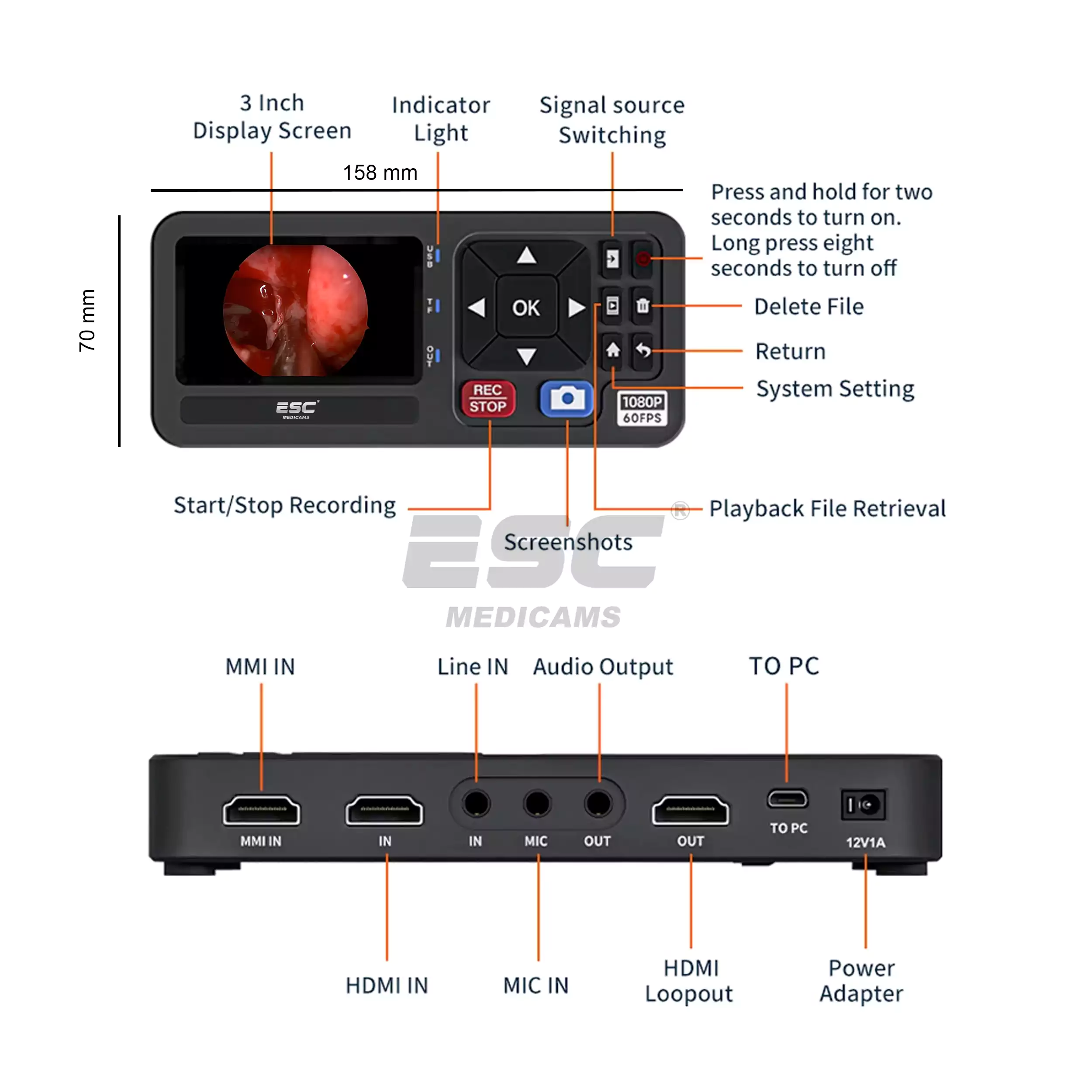 4K Medical Surgical Recorder for Laparoscopy | ESC Medicams