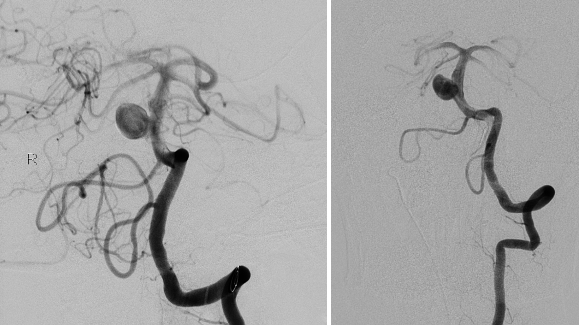 "Easy Procedure, Great Device"