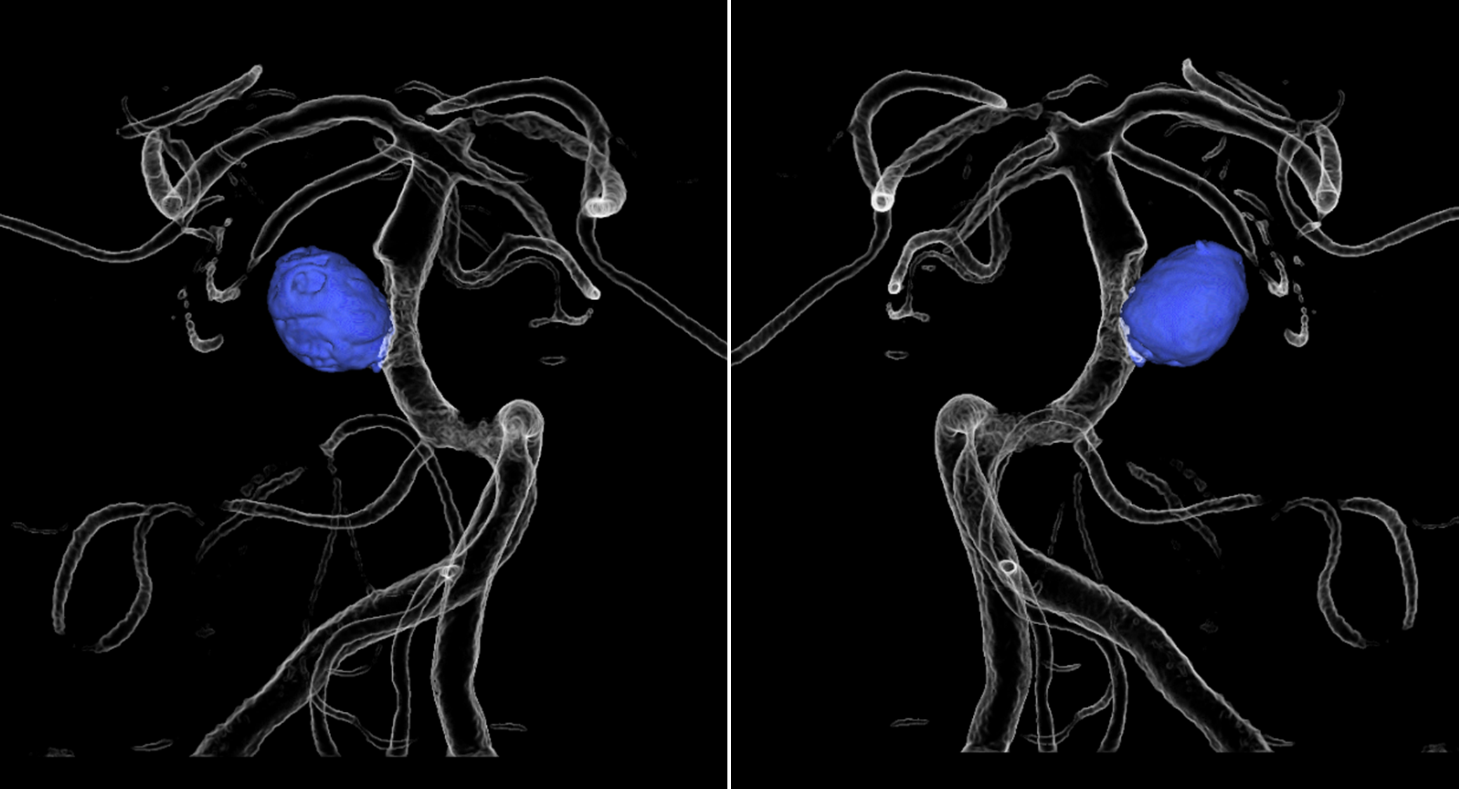 "Easy Procedure, Great Device"