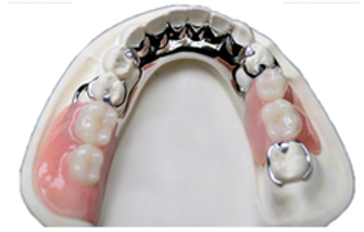 Fast Denture Repairs new dentures partial dentures denture costs