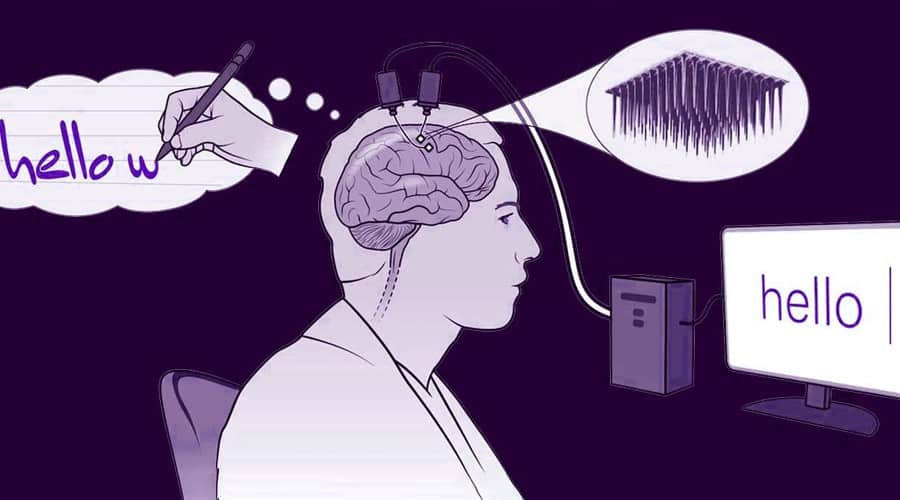 Typing with Your Mind - The Synchron Brain Implant